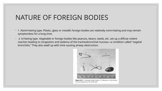 PPT on FOREIGN BODIES IN ENT(_MBBS).pptx