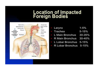 Foreign bodies of air passages | PPTX