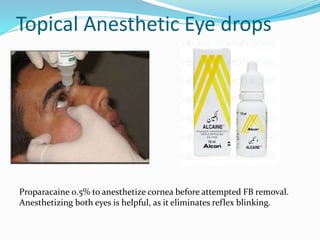 corneal Foreign body In eyes.pptx