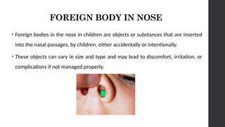 FOREIGN BODY -ASPIRATION, NOSE, EAR.pptx