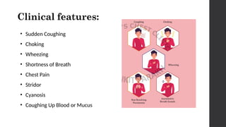 FOREIGN BODY -ASPIRATION, NOSE, EAR.pptx