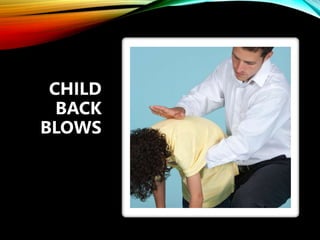 FOREIGN BODY AIRWAY OBSTRUCTION (CHOKING) | PPTX