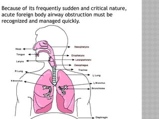 foreign body air way obstruction- . pptx | PPTX