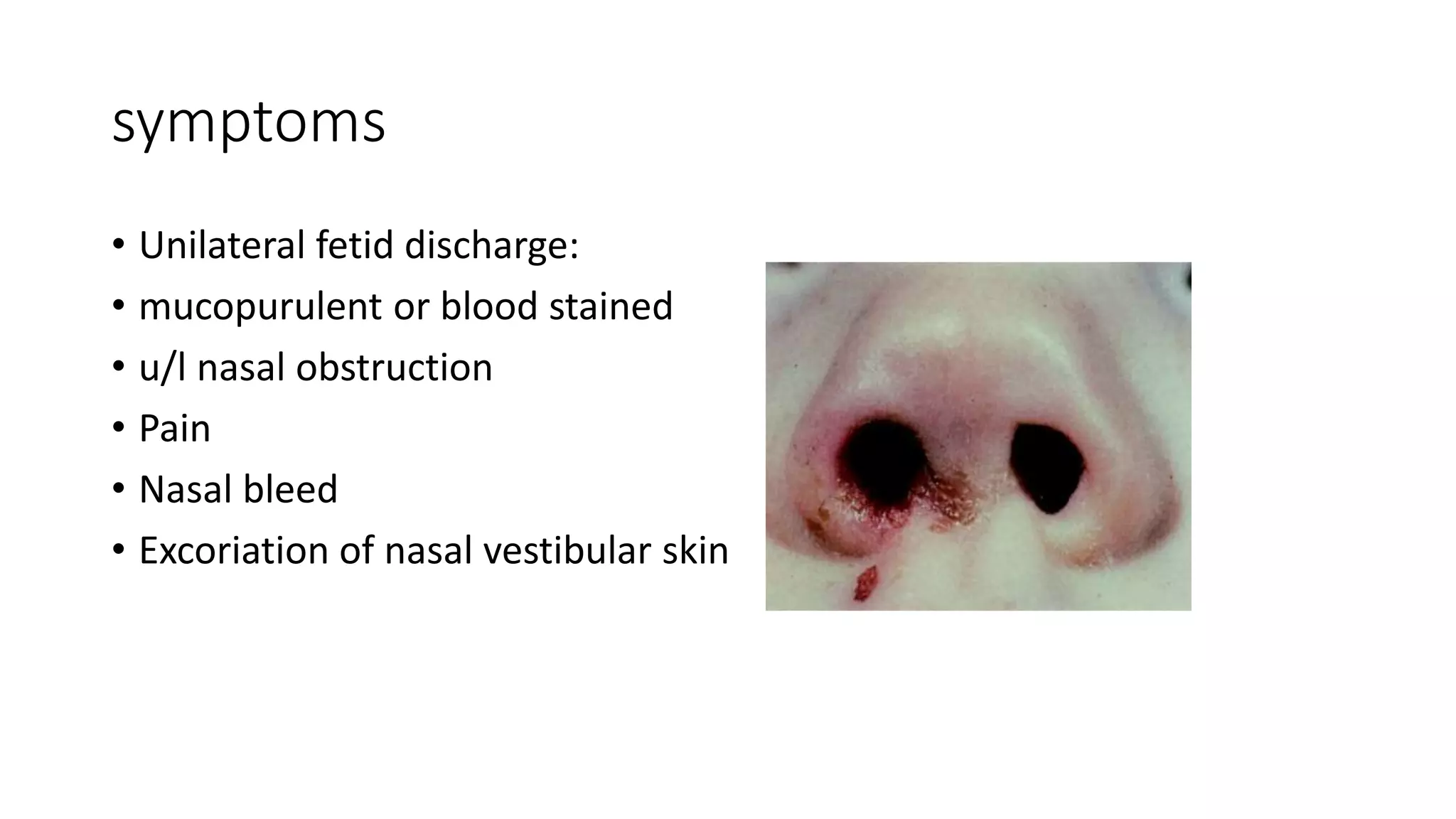 Foreign body in ENT | PPTX