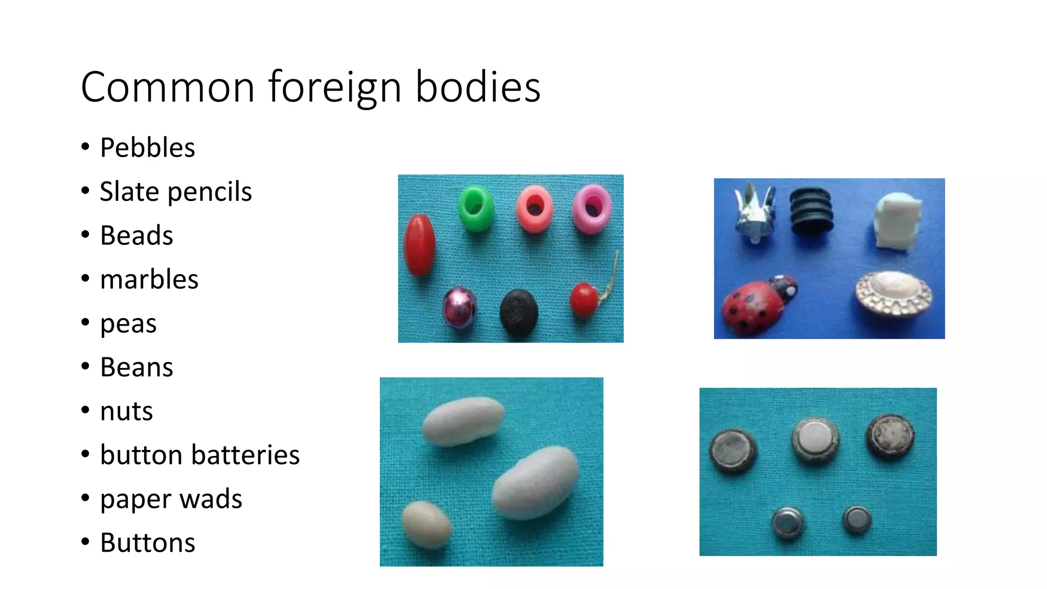 Foreign body in ENT | PPTX