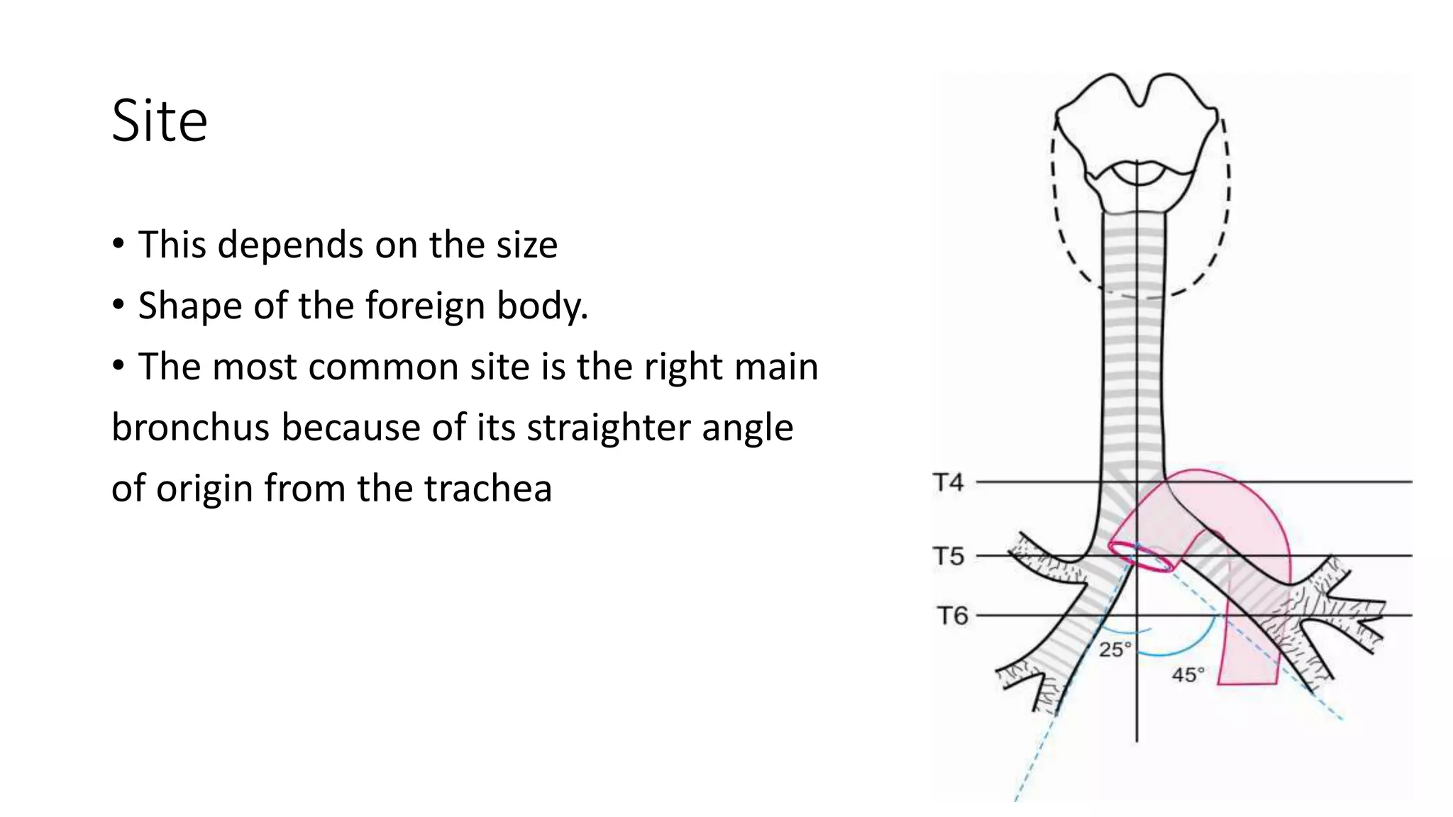 Foreign body in ENT | PPTX