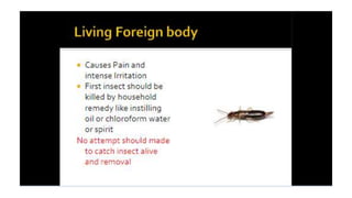 Foreign body in ENT | PPTX