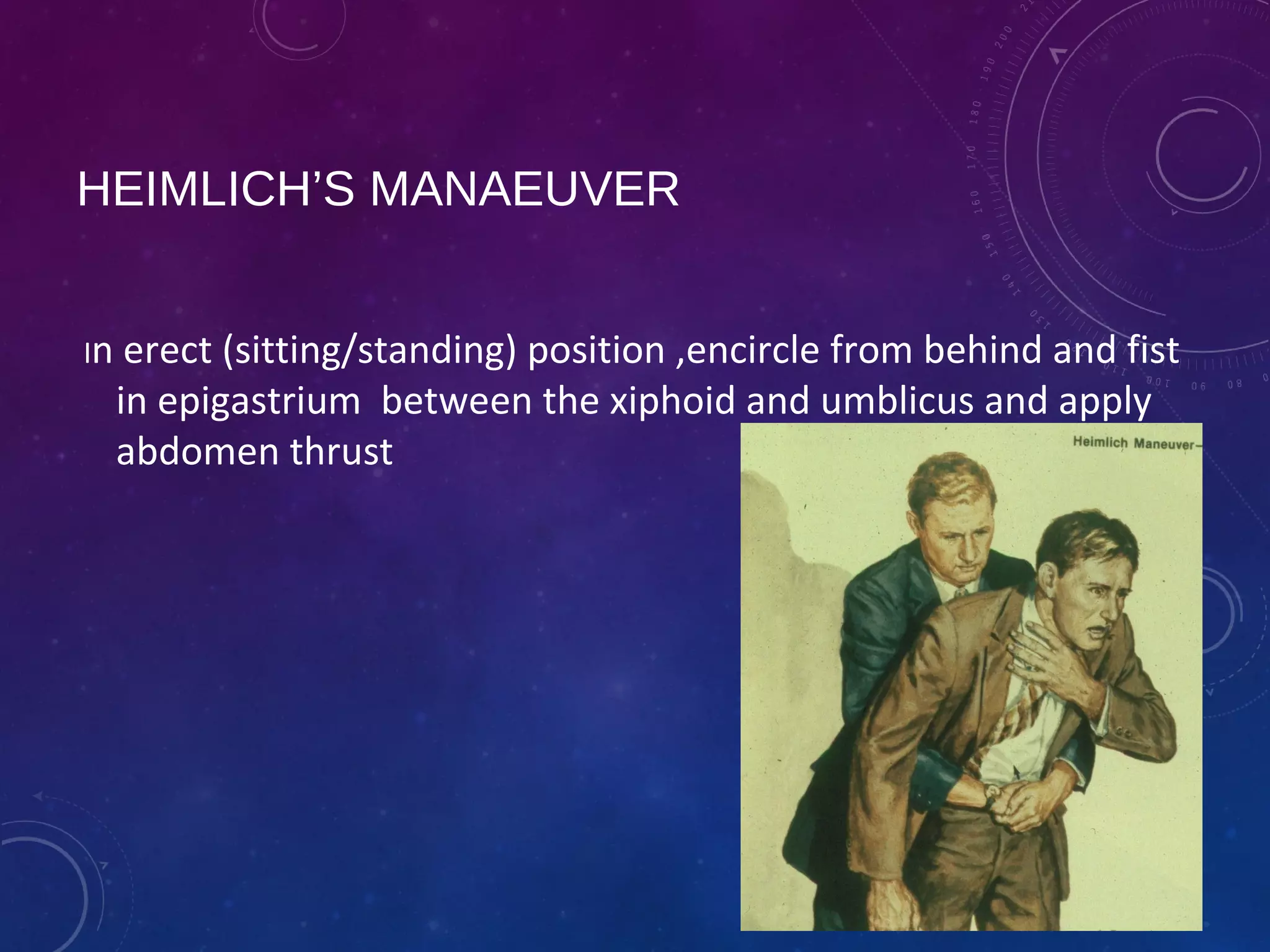 management of foreign body inhalation and bronchoscopy in children | PPT