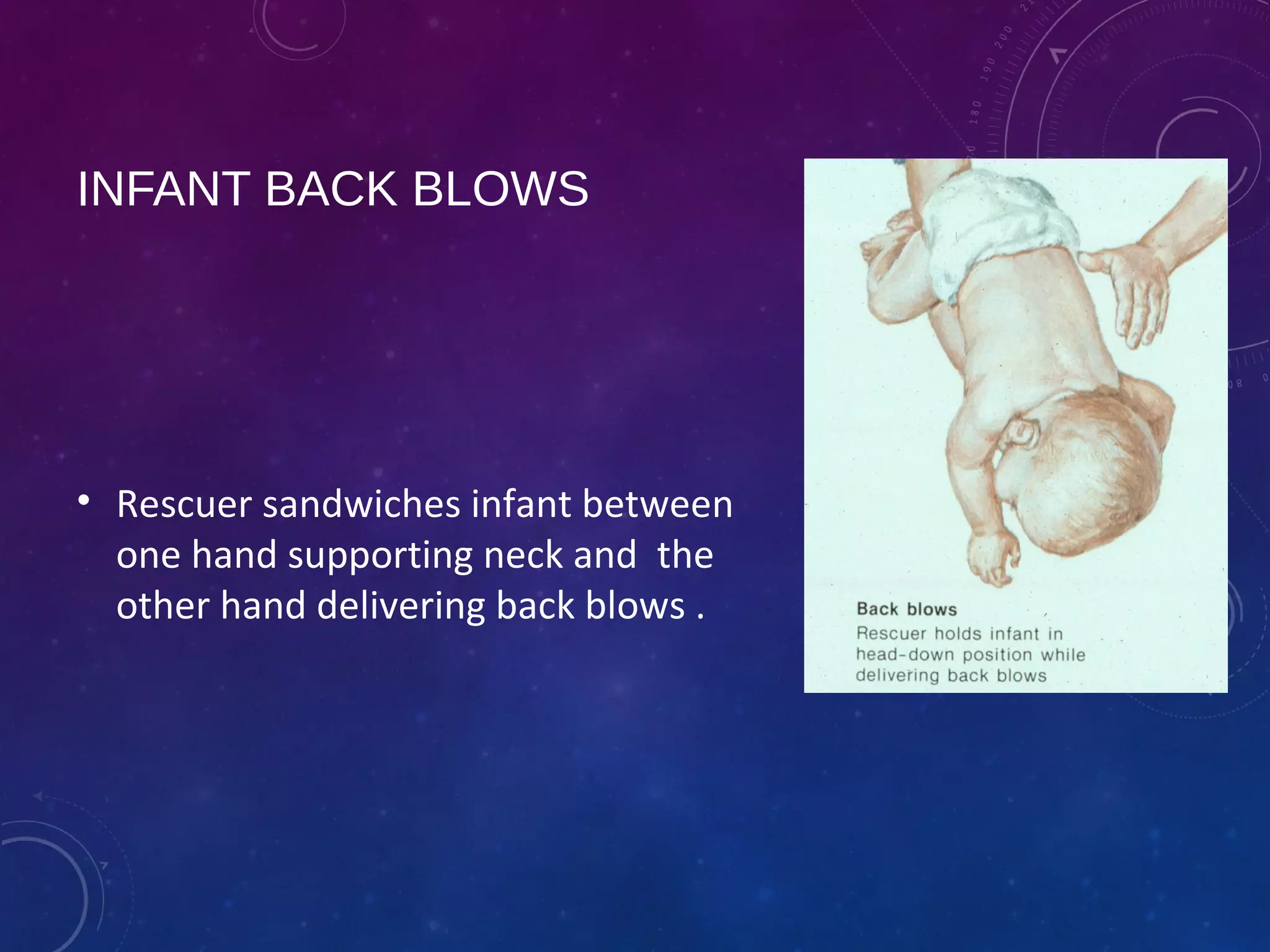 management of foreign body inhalation and bronchoscopy in children | PPT