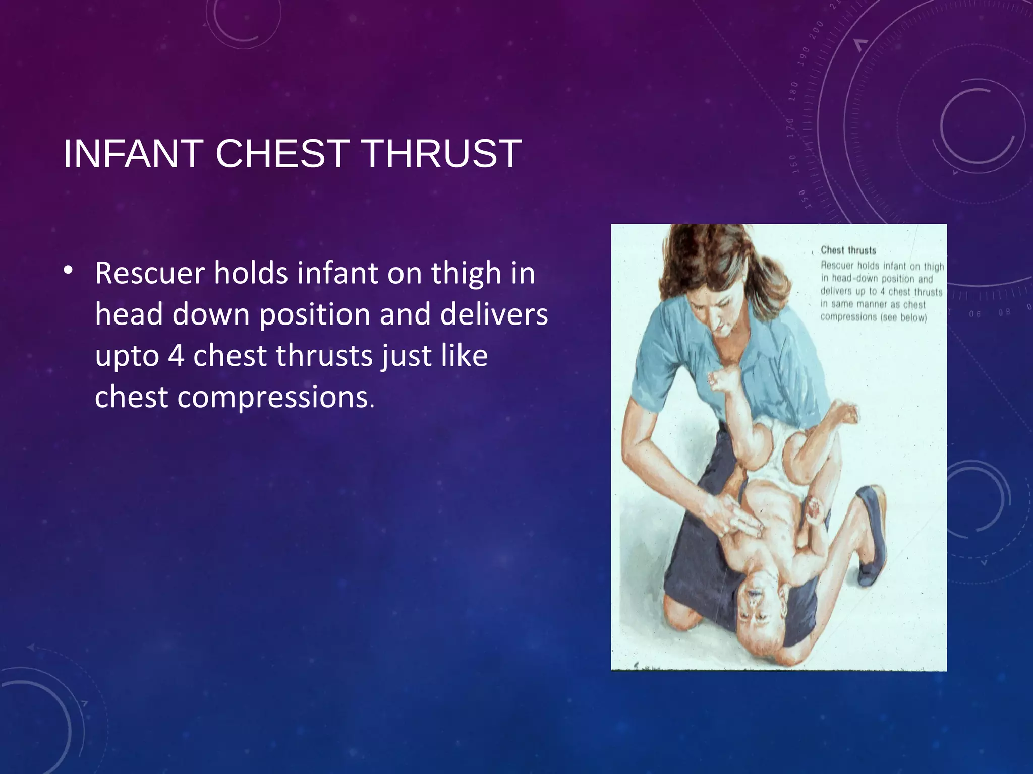 management of foreign body inhalation and bronchoscopy in children | PPT