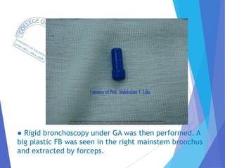 Foreign Body Inhalation with Surgical Emphysema.pdf