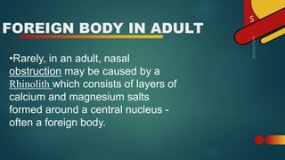 Foreign body in nose by prachi sable .pptx | Ear, Nose and Throat ...