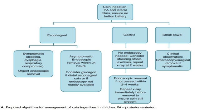 Foreign body in pediatrics | PPTX