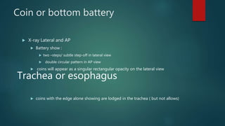 Foreign body in pediatrics | PPTX