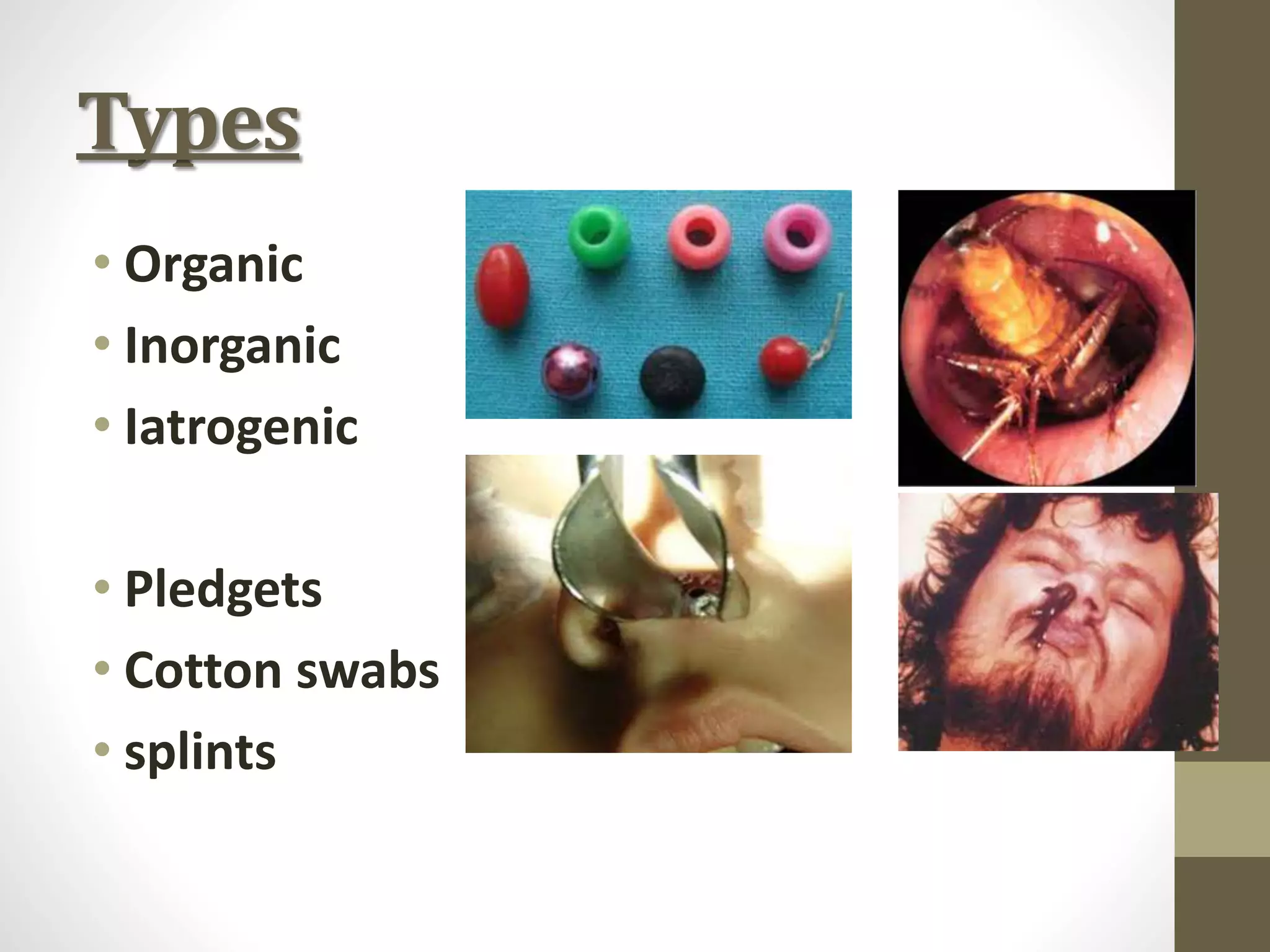 Foreign body nose | PPT
