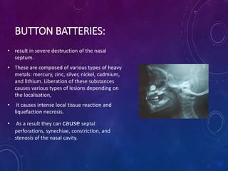 Foreign body nose | PPTX