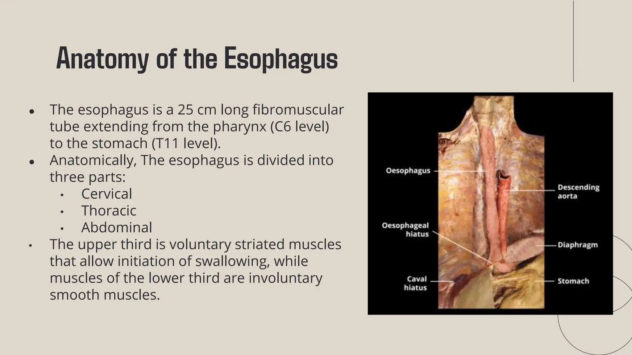 Foreign Body Obstruction - Esophagus.pptx