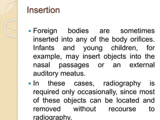 foreign body radiography.pptx