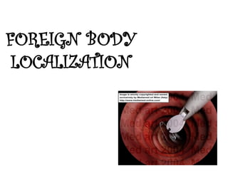 FOREIGN BODY RADIOGRAPHY MEDICAL IMAGING.ppt