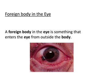 Foreign body & trauma to the eye | PPTX