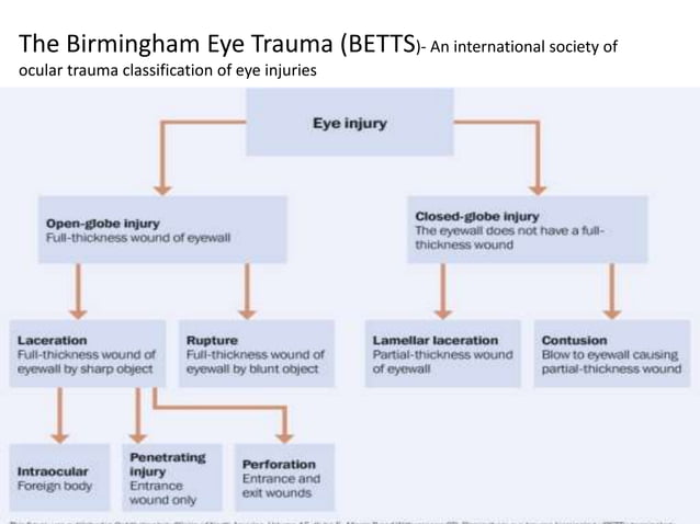 Foreign body & trauma to the eye | PPTX
