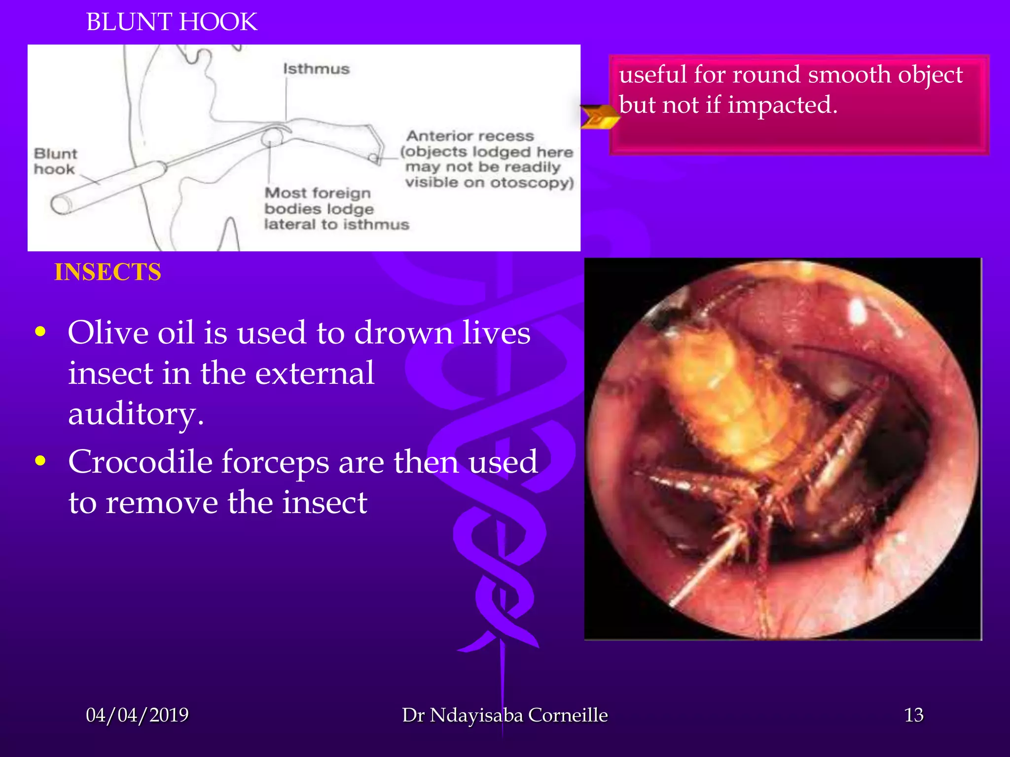 Forein body in the ear and the nose management | PPTX