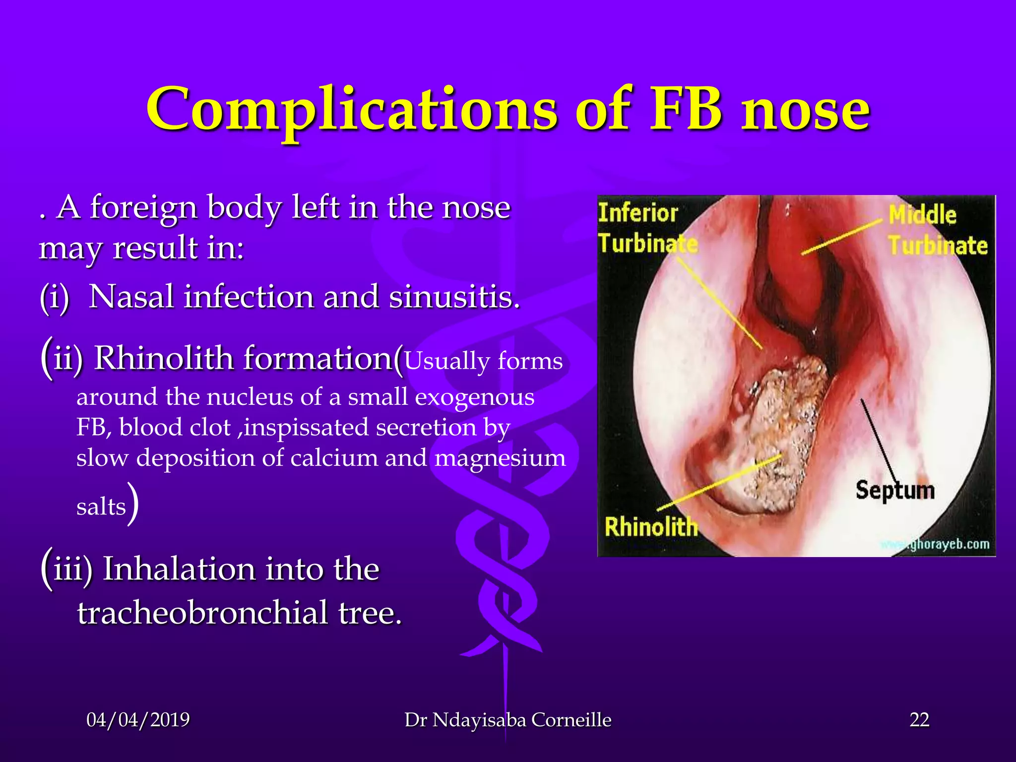 Forein body in the ear and the nose management | PPTX
