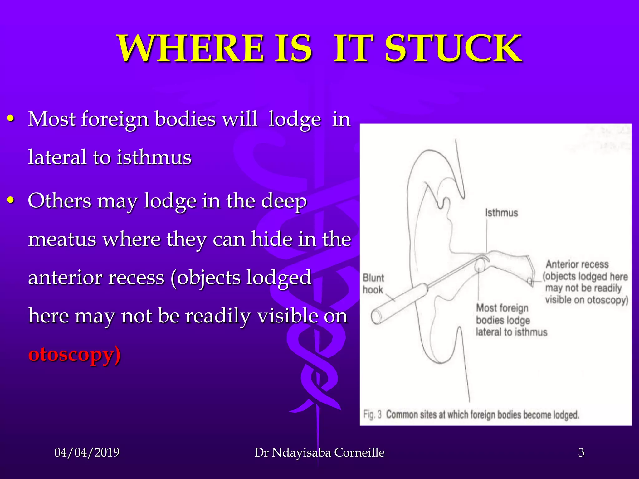 Forein body in the ear and the nose management | PPTX
