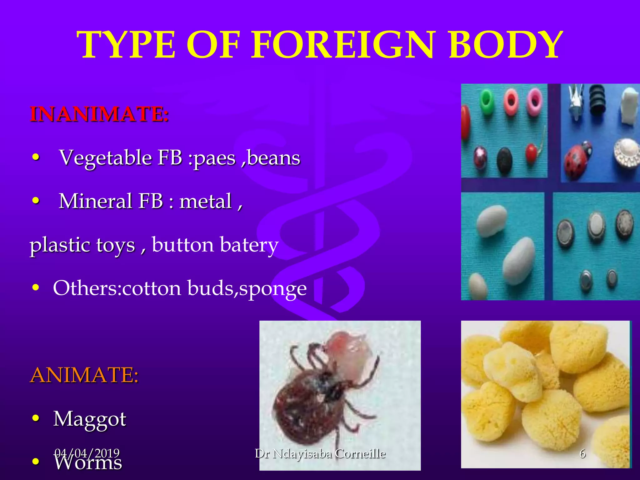 Forein body in the ear and the nose management | PPTX