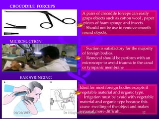 Forein body in the ear and the nose management | PPTX