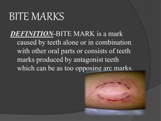 Forensic Odontology | PPT