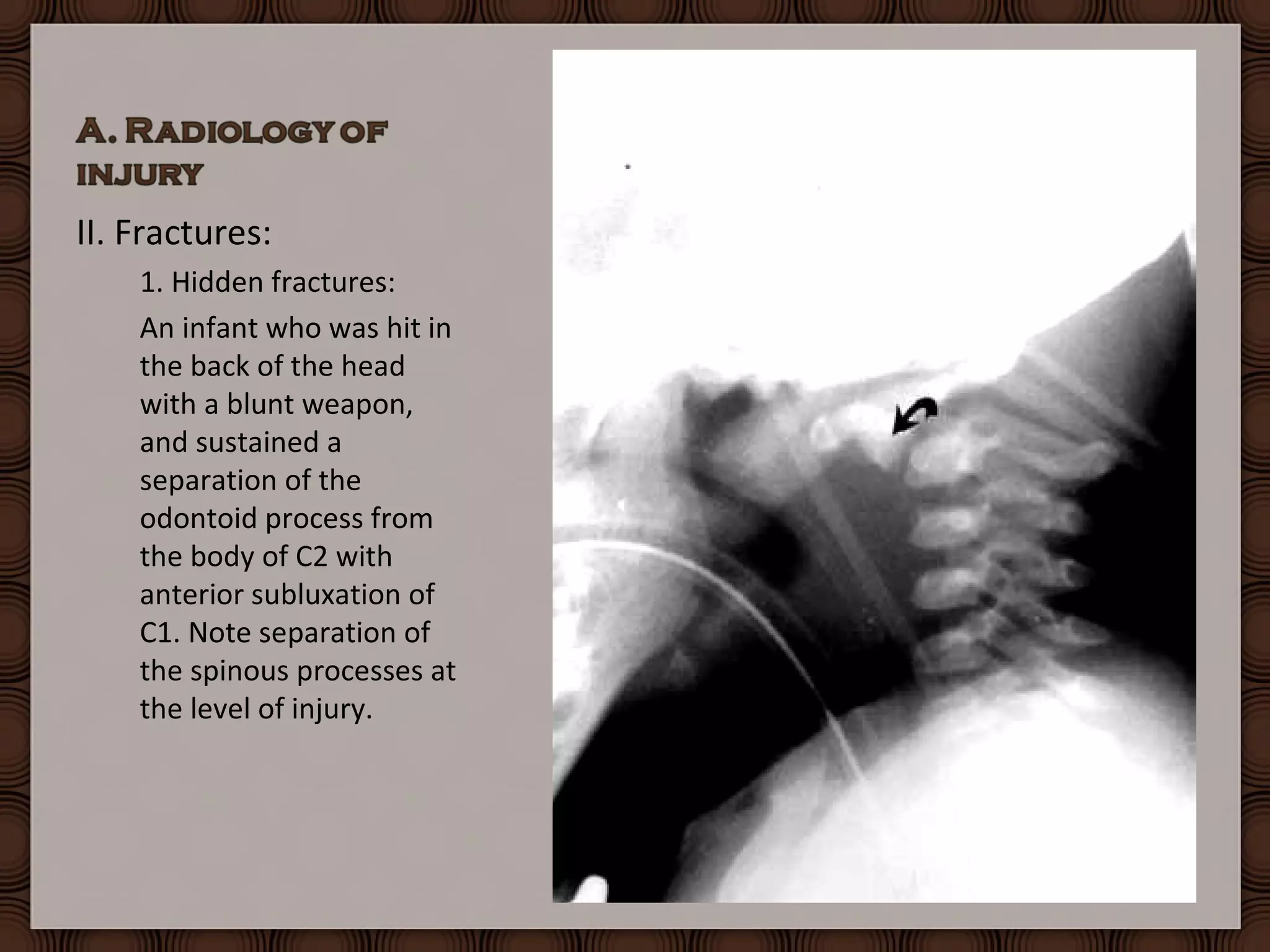 Forensic Radiology Practical Under | PPT