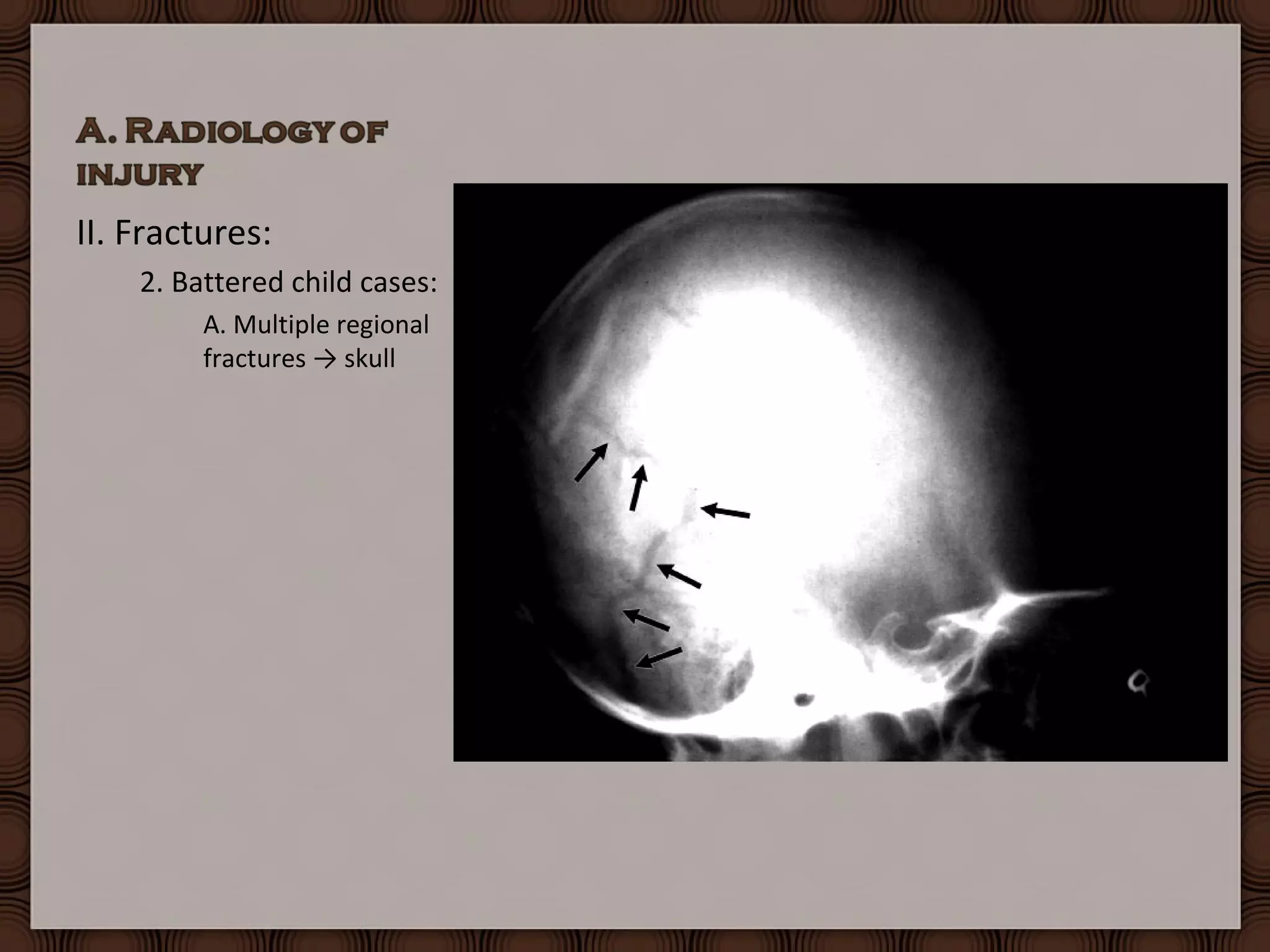 Forensic Radiology Practical Under | PPT