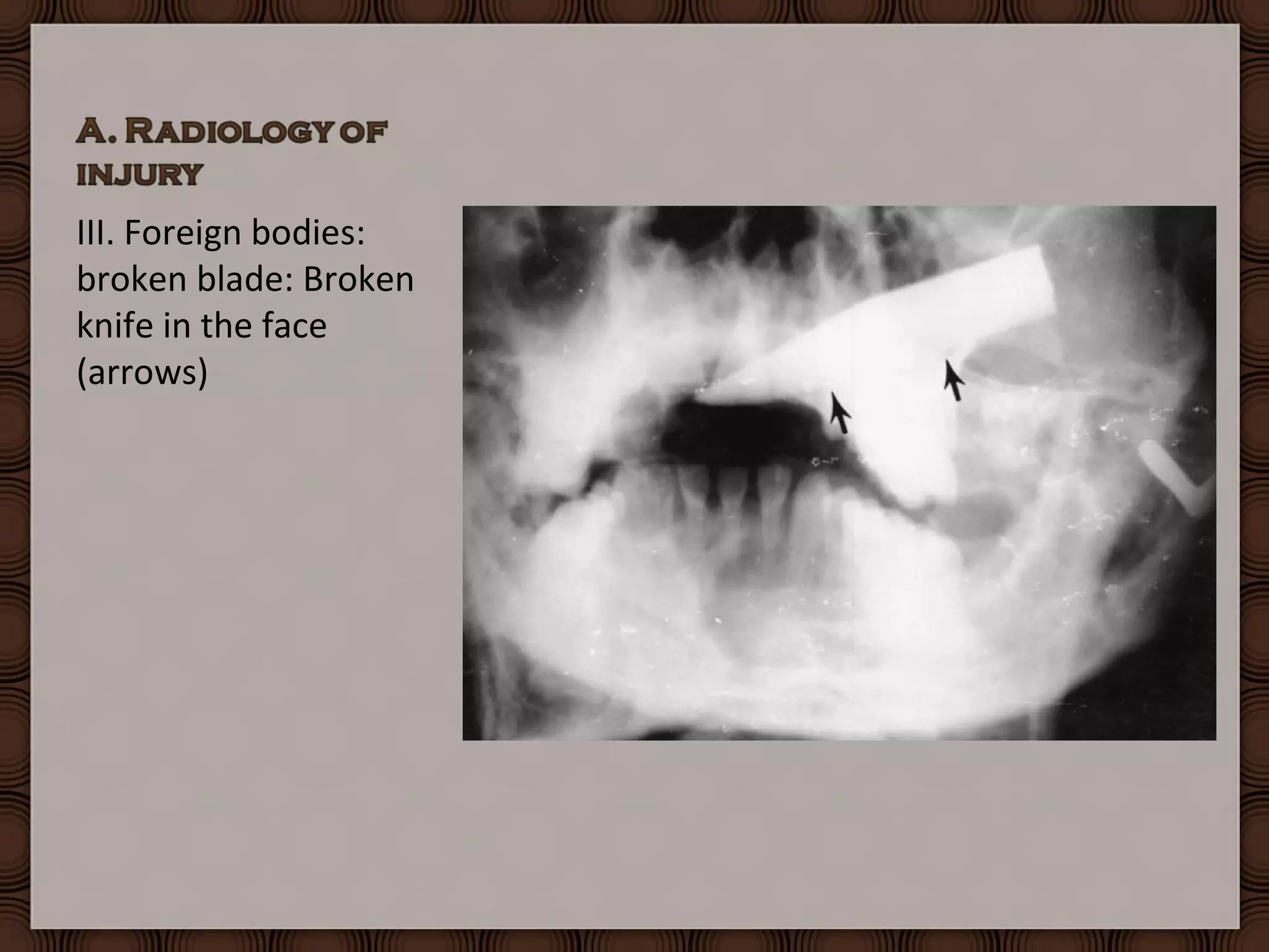 Forensic Radiology Practical Under | PPT