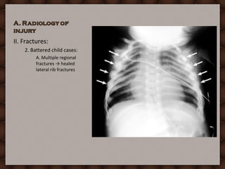 Forensic Radiology Practical Under | PPT