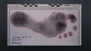 Forensic Analysis of Bare Footprint .pptx