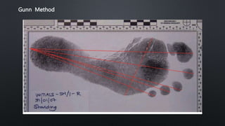 Forensic Analysis of Bare Footprint .pptx