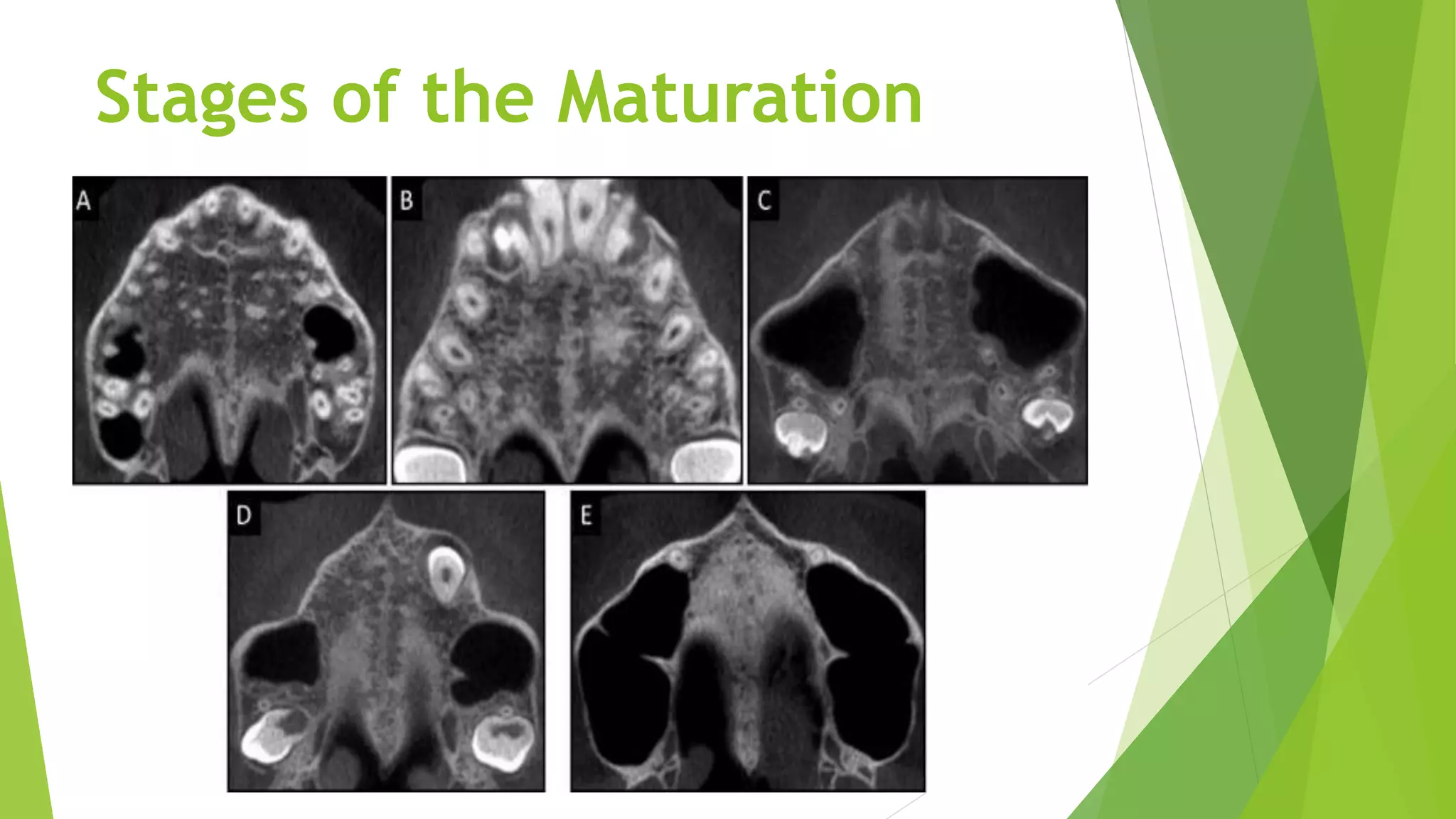 Forensic Anthropology* Sutures of the Skull | PPTX