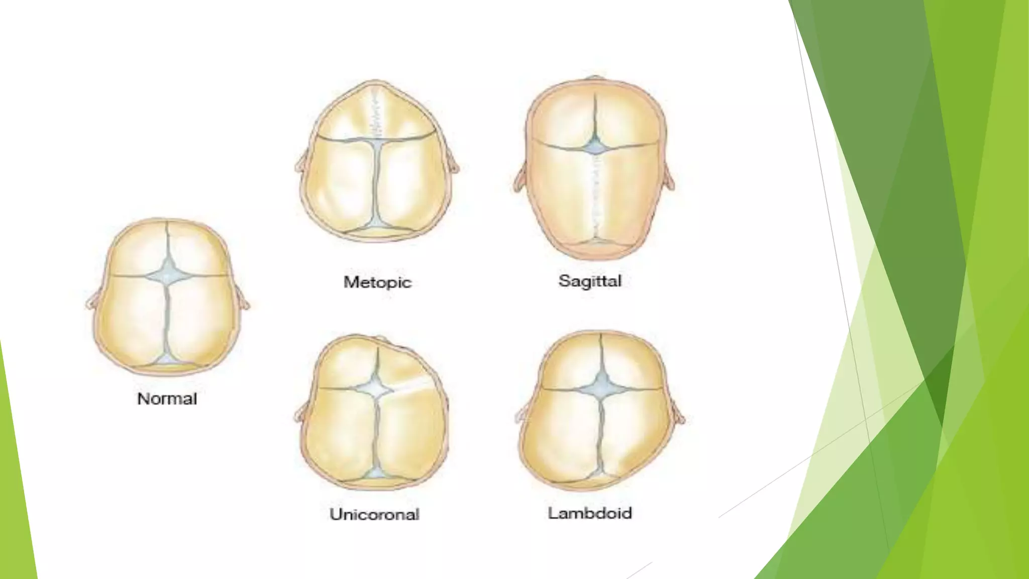 Forensic Anthropology* Sutures of the Skull | PPTX