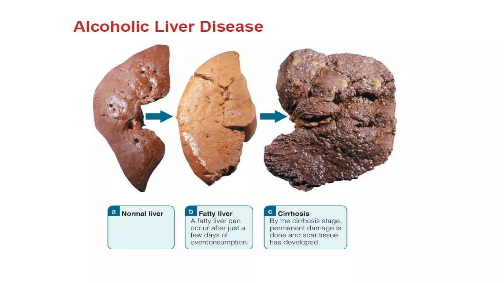 Forensic aspects of alcohol | PPTX