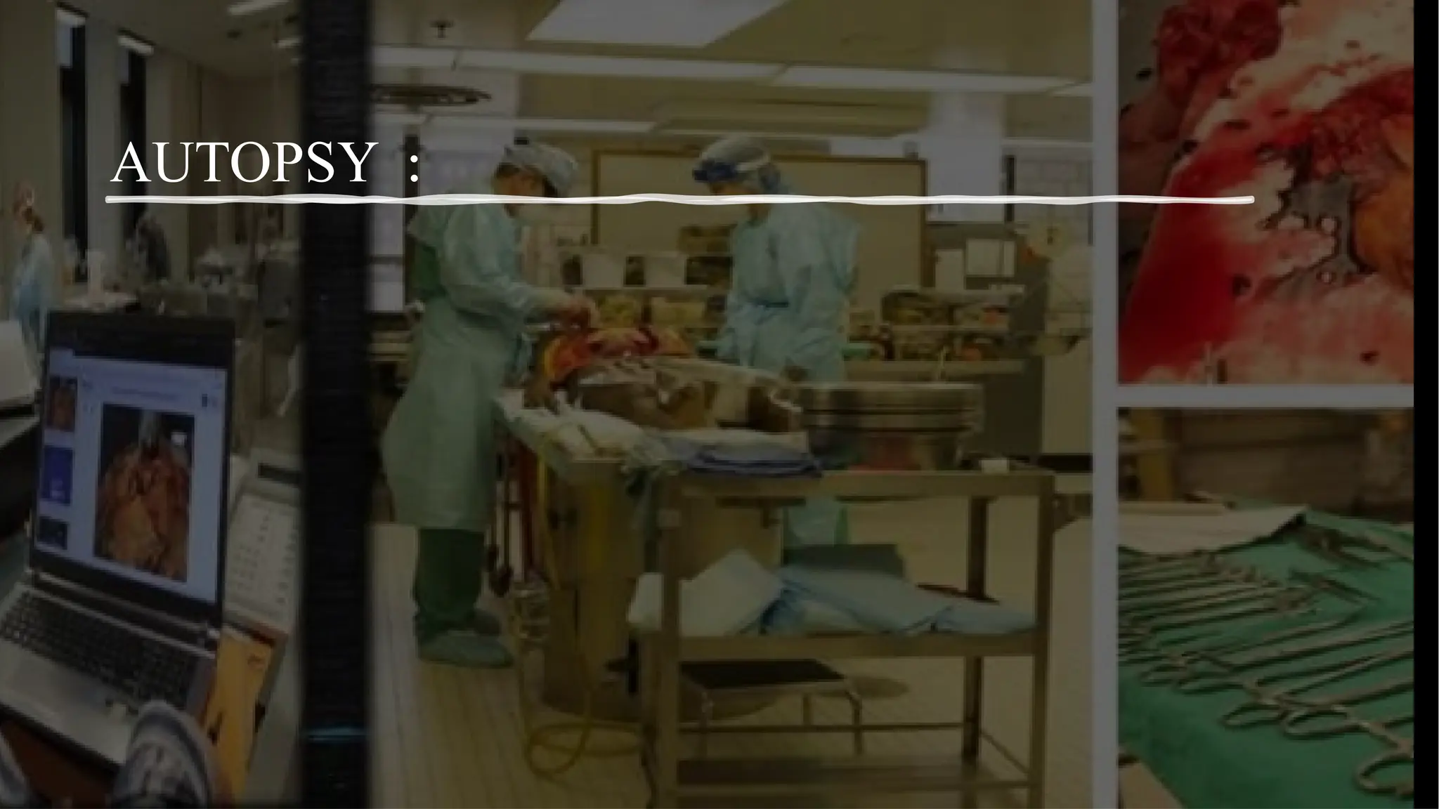 forensic autopsy ppt.pptx types of autopsy different types of incisions ...