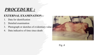 forensic autopsy ppt.pptx types of autopsy different types of incisions ...