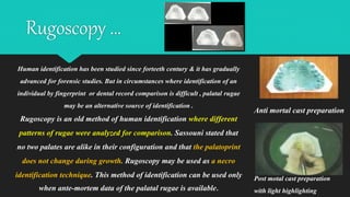 Forensic dentistry | PPT