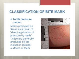 Forensic dentistry | PPTX
