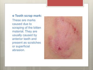 Forensic dentistry | PPTX