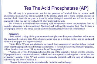 Forensic dna analysis | PPT