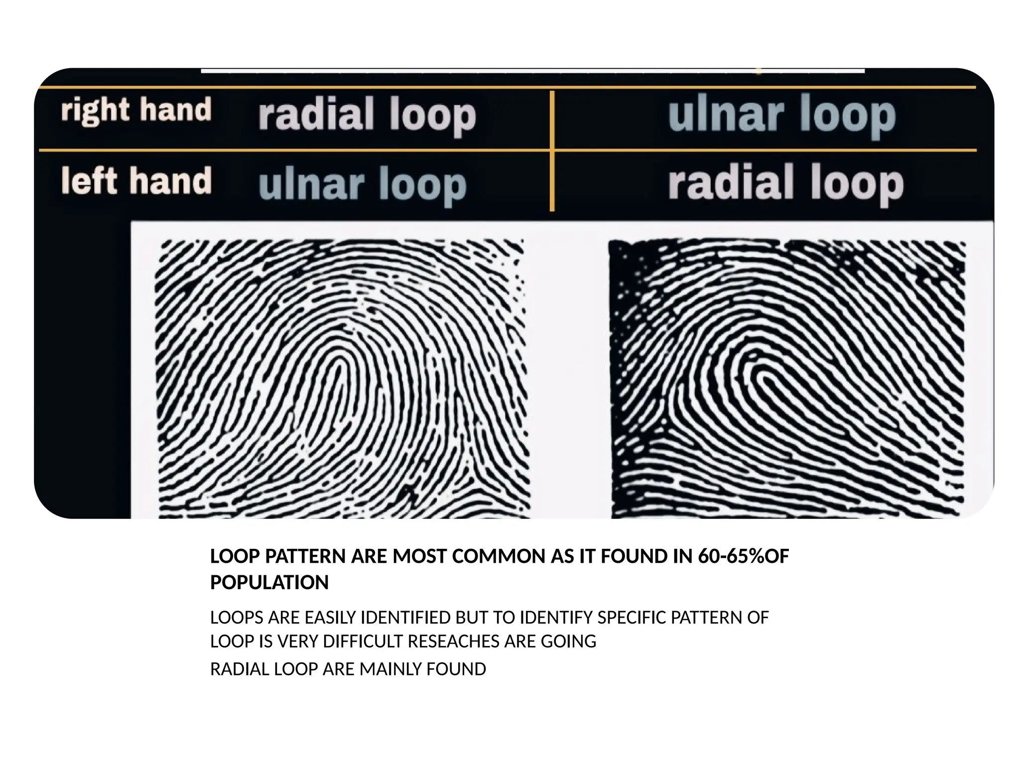 FORENSIC Fingerprinting means dermatoglyphics(fingerprint) | PPTX