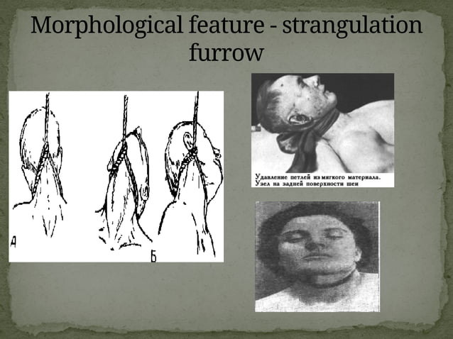FORENSIC MEDICAL EXAMINATION OF MECHANICAL ASPHYXIA.pptx