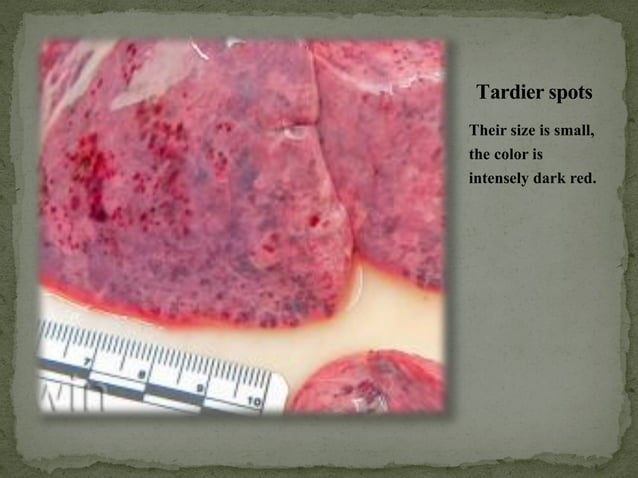 FORENSIC MEDICAL EXAMINATION OF MECHANICAL ASPHYXIA.pptx