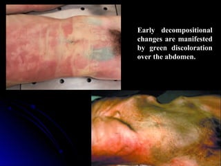 Forensic medical theory of death | PPT